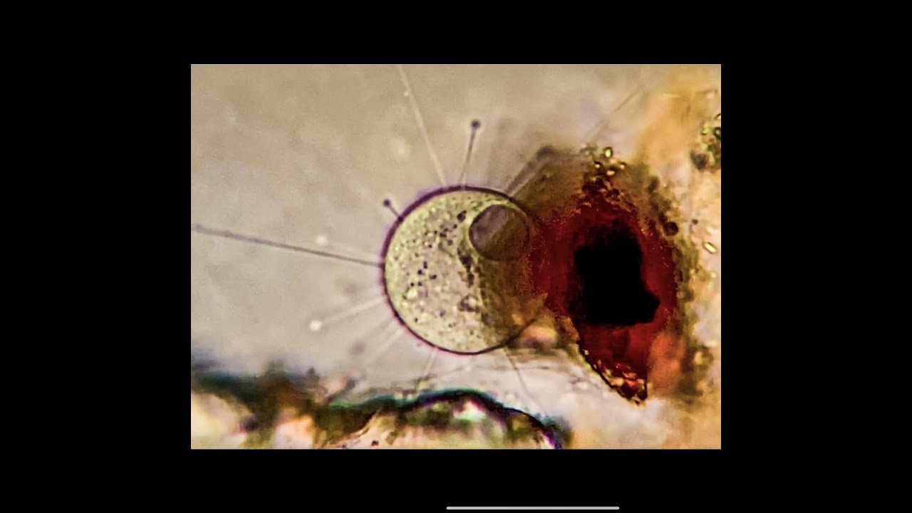 Microscopy - A Suctorian - YouTube