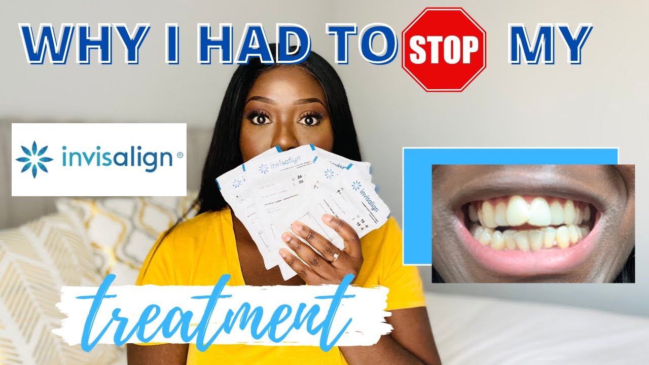 Stopping My Invisalign Treatment: Teeth Transformation - YouTube