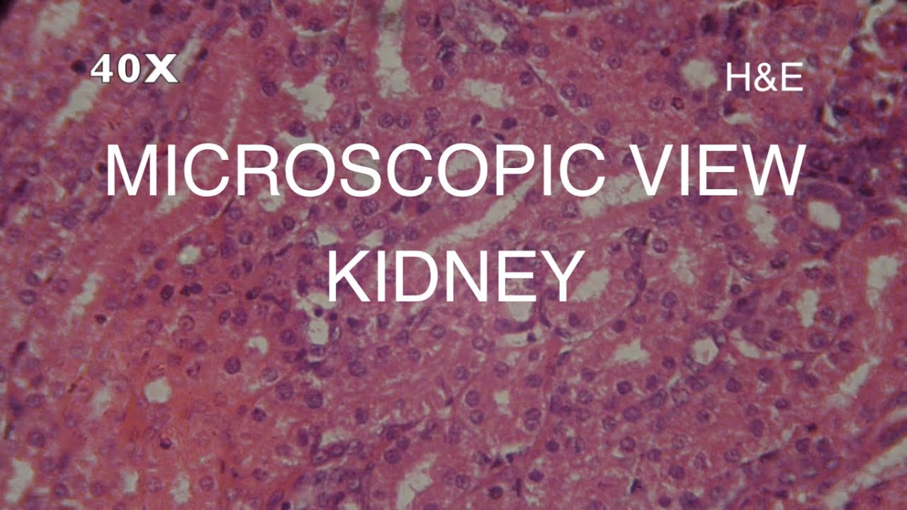 MICROSCOPIC VIEW- KIDNEY - YouTube