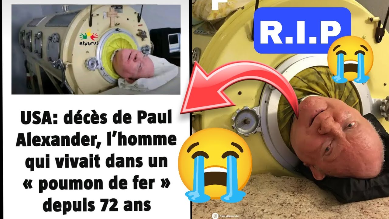 PAUL ALEXANDER : L'HOMME QUI A VÉCU PENDANT 72 ANS DANS UN POUMON DE ...