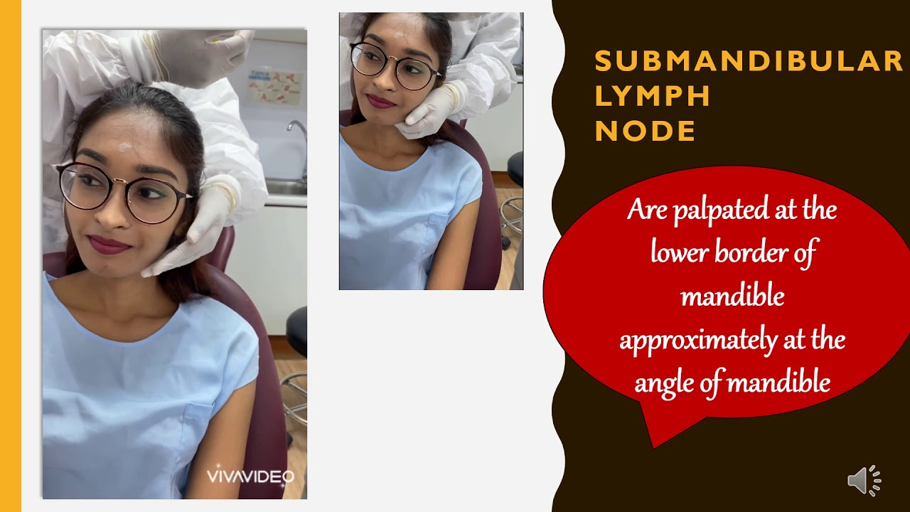 LYMPH NODE EXAMINATION- head and neck region - YouTube