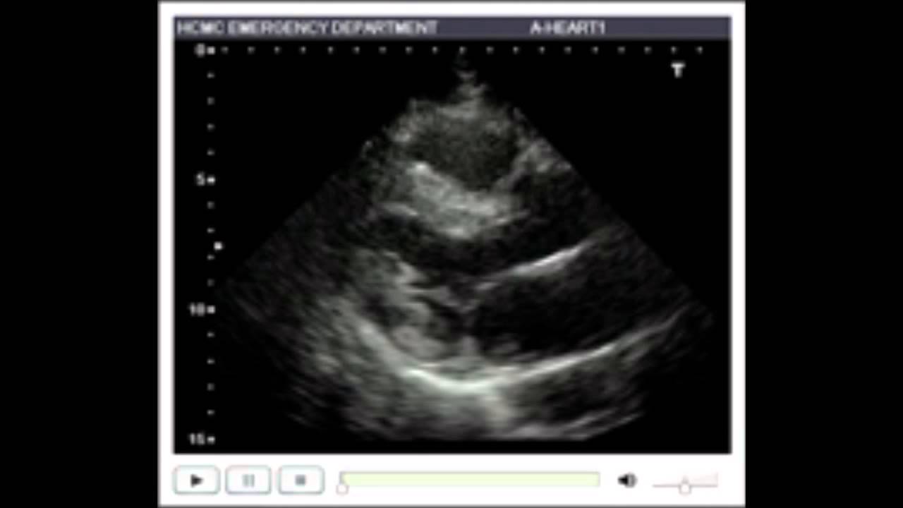 FAST Scan tutorial - YouTube