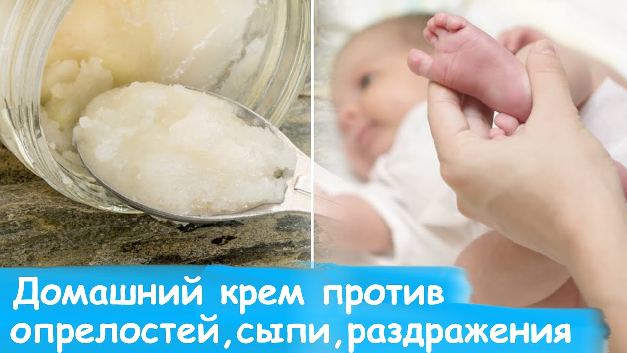 Как Приготовить Домашнюю Мазь от Опрелостей, Потертостей, Раздражения ...