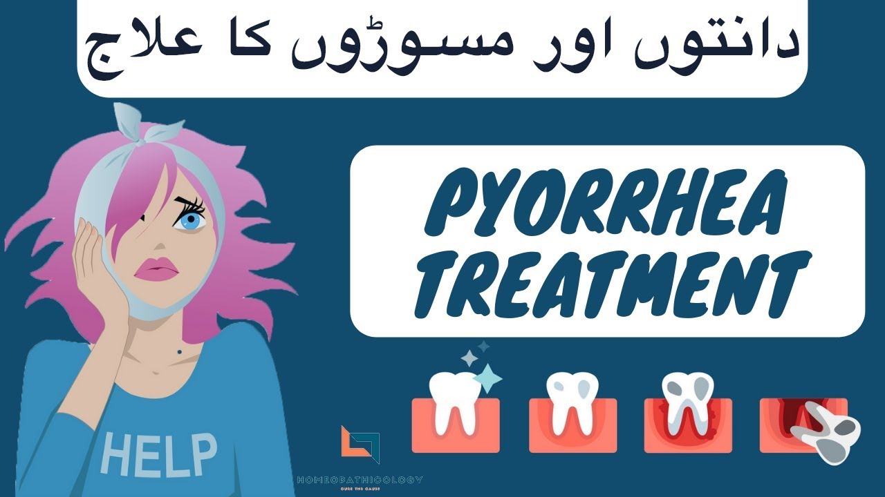 Pyorrhea Treatment | Homeopathic Medicine for Periodontitis | Gum ...