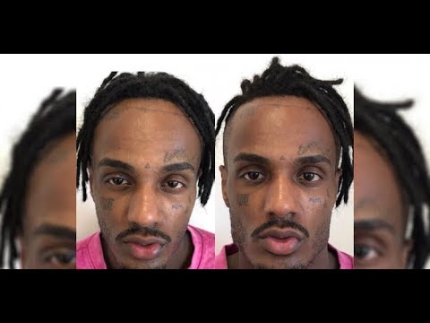 Derek da Recayd Mob faz procedimento estético para ficar mais bonito e ...