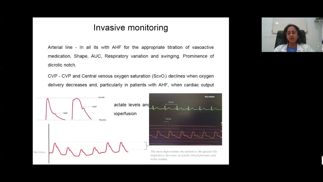 Managing acute heart failure in ICU by Dr Tanuja Karande - YouTube
