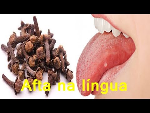 Afta na língua: como curar mais rápido e principais causas? - YouTube