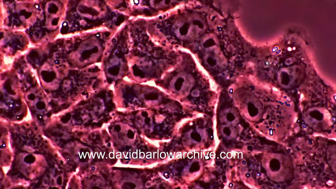 BGMK Cells Spreading as a Sheet - YouTube