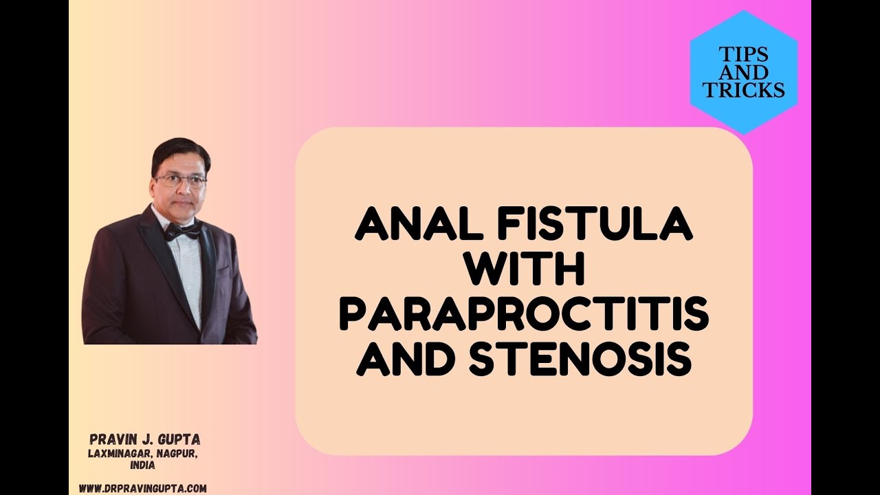 ANAL FISTULA WITH PARAPROCTITIS AND ANAL STENOSIS - YouTube