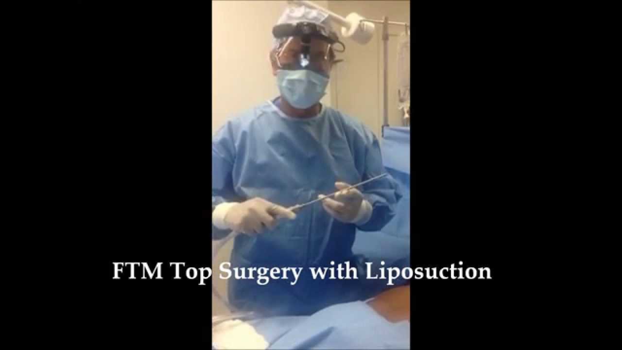 FTM Top Surgery with Liposuction in the Operating Room - YouTube