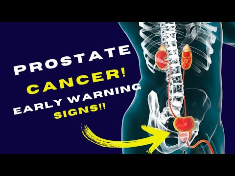 Prostate Cancer Symptoms | Weak Urinary Stream - YouTube