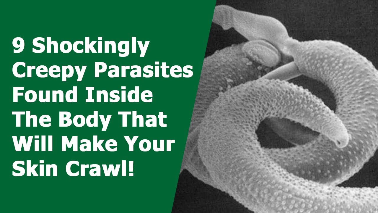 9 Shockingly Creepy Parasites Found Inside The Body That Will Make Your ...