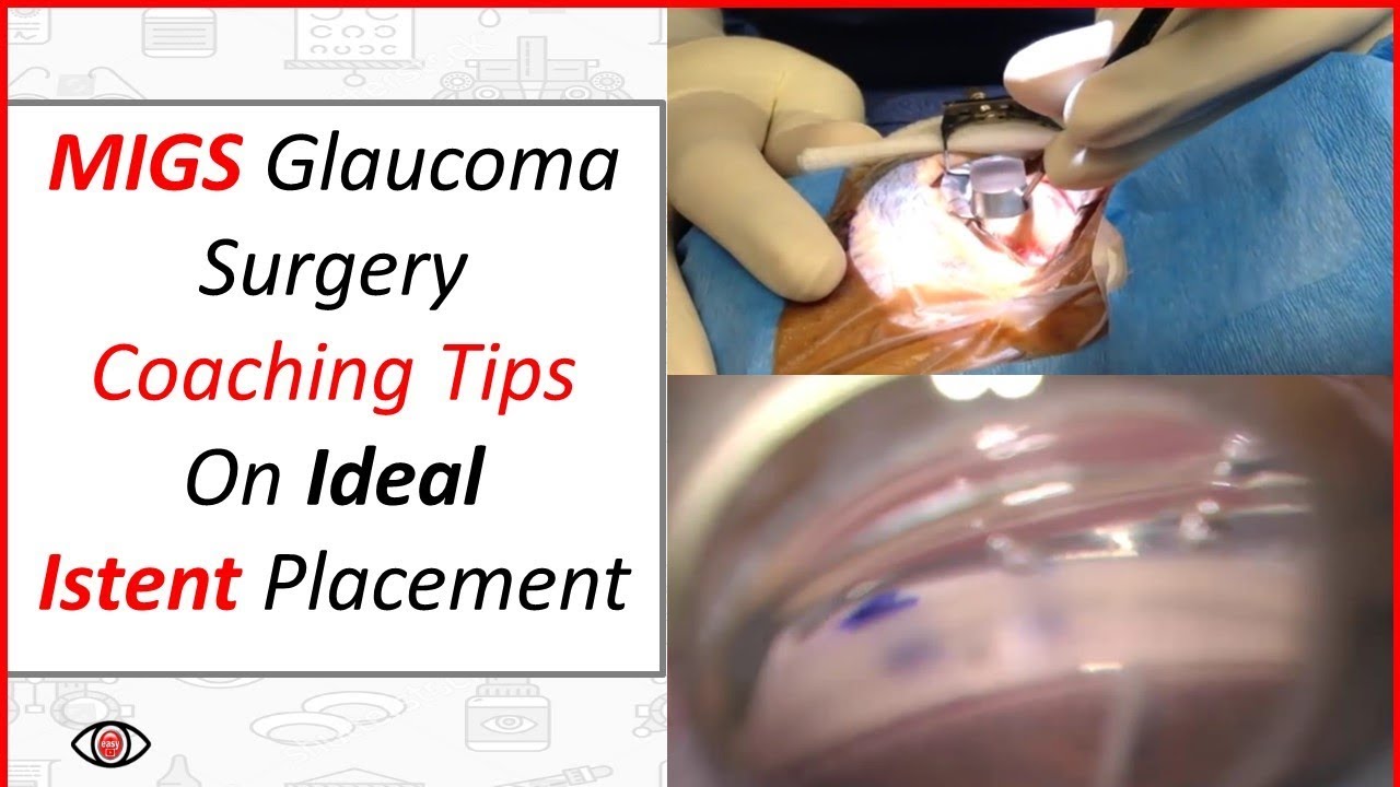 Glaucoma Cataract Surgery The Istent Procedure Eye