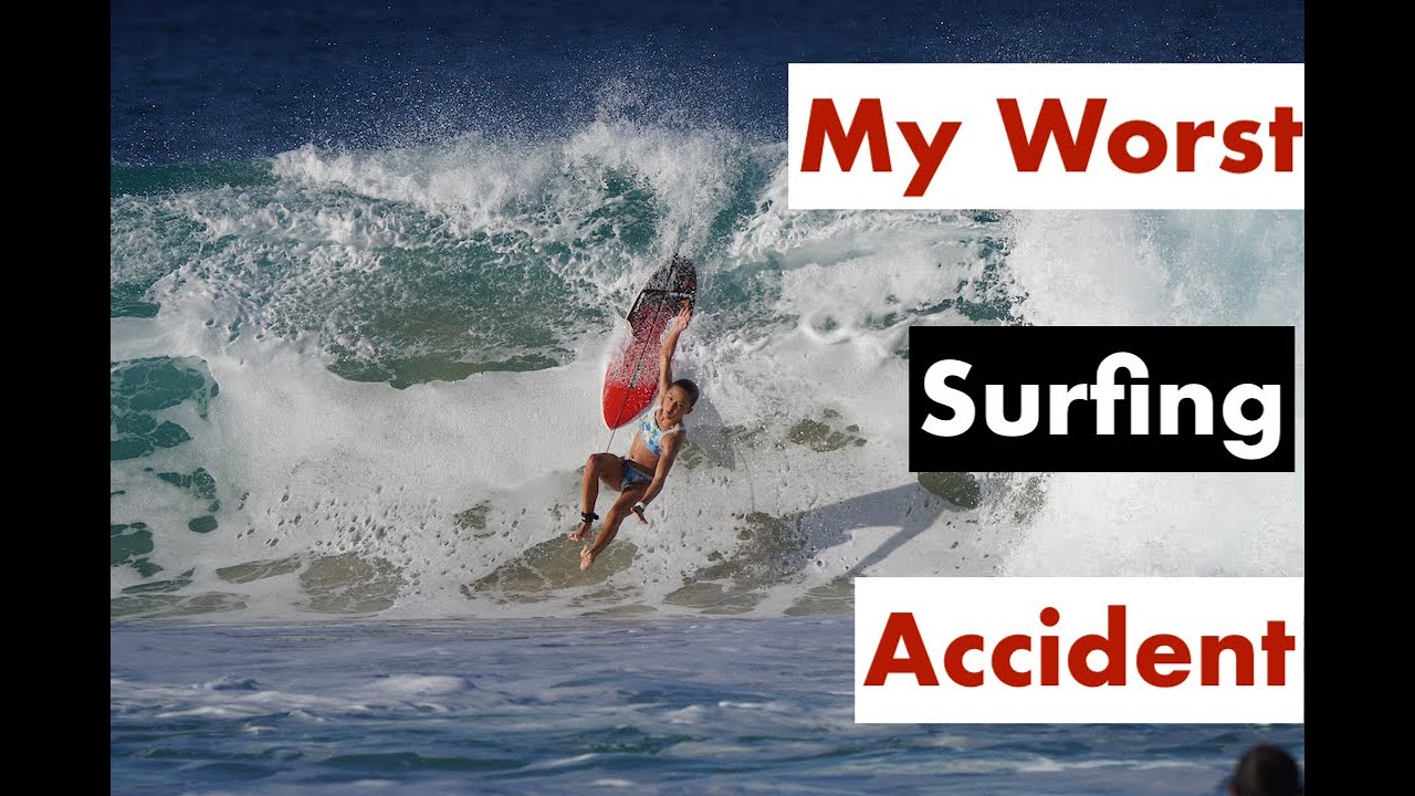 My WORST SURFING ACCIDENT & what I could've done to PREVENT it! - YouTube