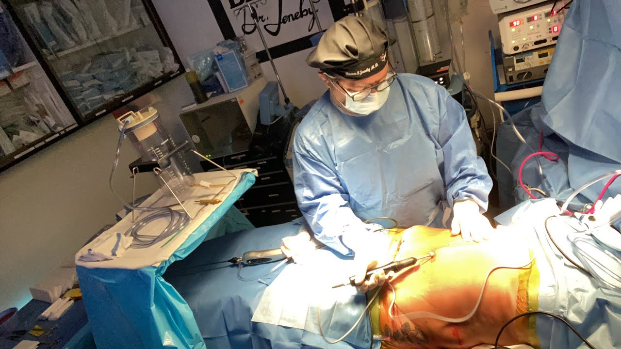 Lipo 360 BBL surgery | Bbl live-streaming - YouTube