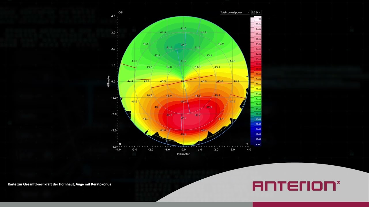 ANTERION Bilderkarussell Animation - YouTube