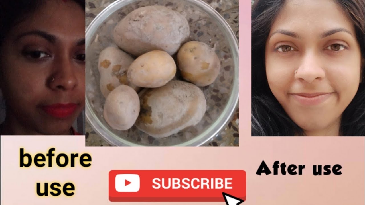 POTATO HONEY FACE MASK FOR SKIN LIGHTENING||GET BLEACHING GLOW ON YOUR ...
