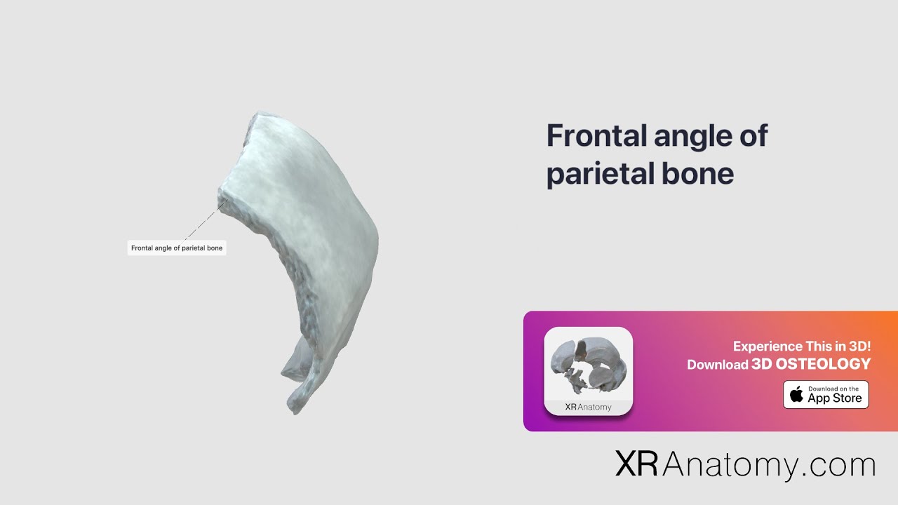 Frontal angle of parietal bone - YouTube