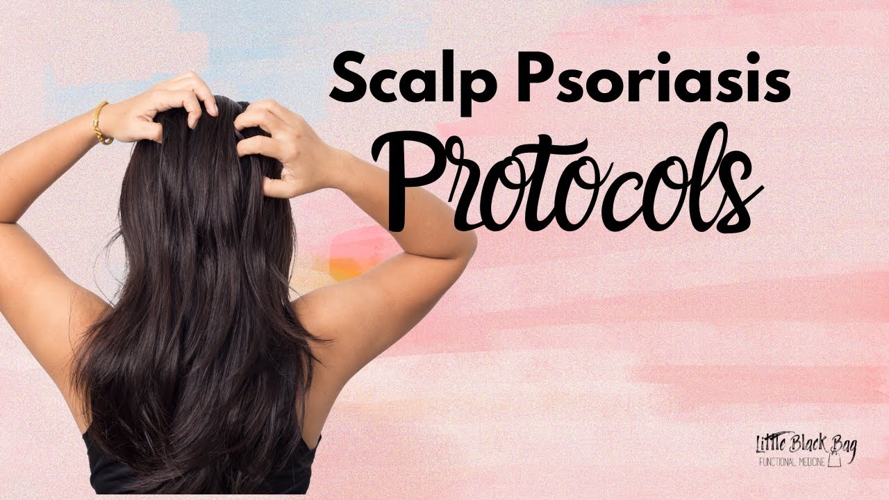 Scalp Psoriasis Support - YouTube
