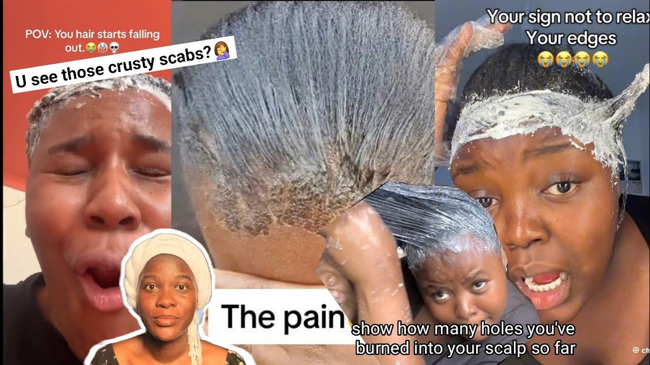 INTERNET'S MOST OUTRAGEOUS RELAXER FAILS & THE SCALP BURN CRIES - YouTube