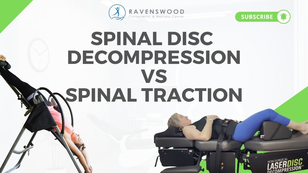 Spinal Decompression vs Spinal Traction - YouTube