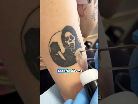 Lazerle Dövme Sildirme Tekniği #ilginçbilgiler #fyp