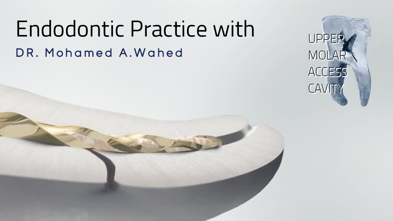 Endodontic practice - Maxillary Molar Access cavity like an Endodontist ...