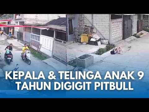 KRONOLOGI Anjing Pitbull di Bandung Serang dan Gigit Anak 9 Tahun hingga Luka di Kepala dan Telinga