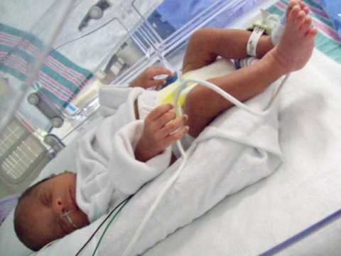 32 week old preemie - YouTube
