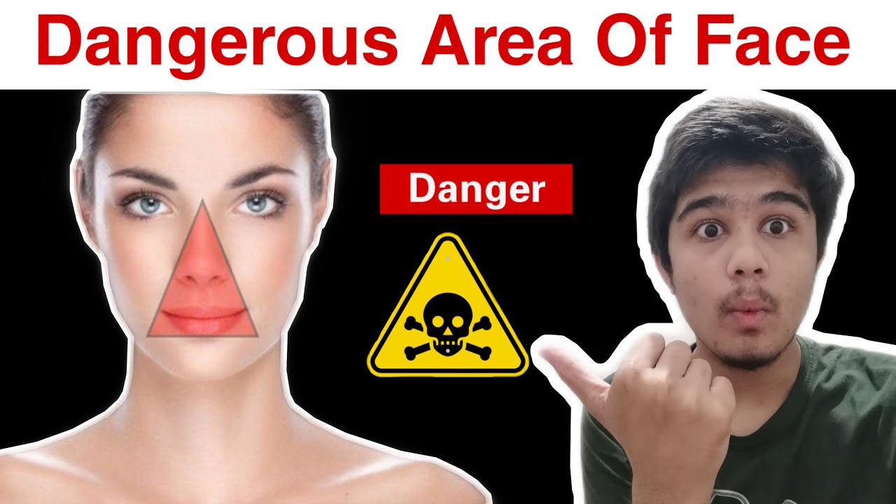 Dangerous Area Of Face | Venous Supply Of Face | Dangerous Triangle Of ...