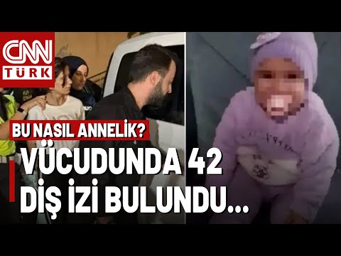 Cinsel İstismar Ve Şiddet! 2 Yaşındaki Sıla Bebek Küçük Bedeniye, Hayat Mücadelesi Veriyor...