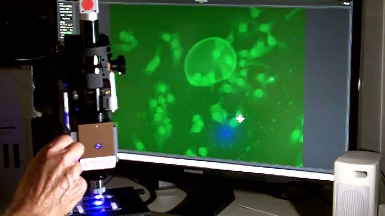 HIGH SPEED MICROFLUIDIC IMAGING SYSTEM WITH INCIDENT LIGHT FLUORESCENCE ...