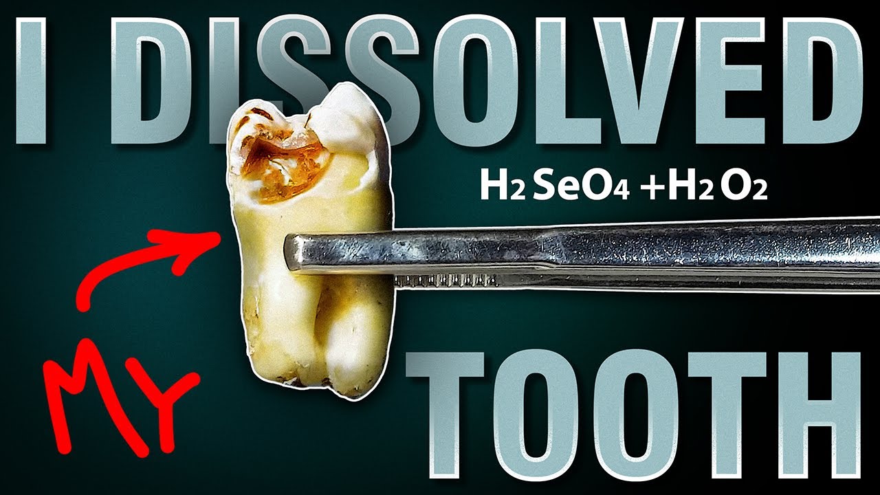 I Dissolved My Tooth in SELENIC Piranha! - YouTube