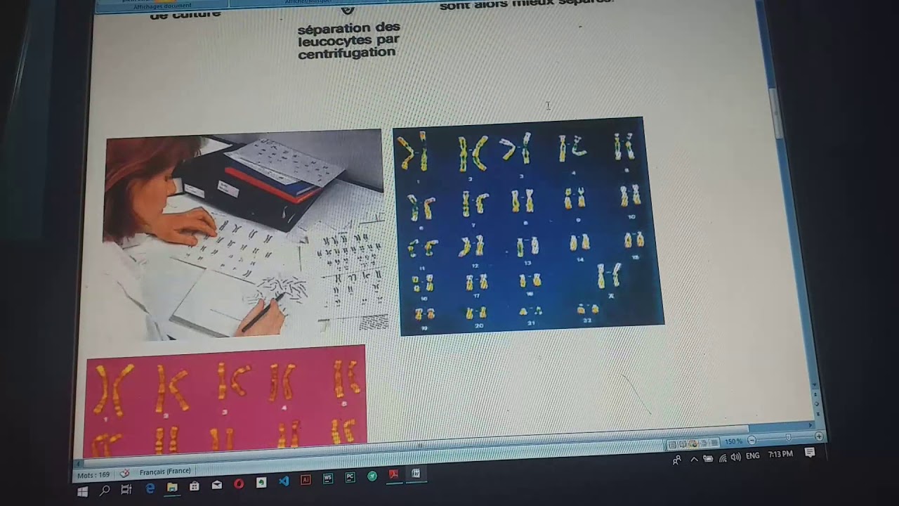 LA GENETIQUE HUMAINE: les etapes de la realisation d'un caryotype - YouTube