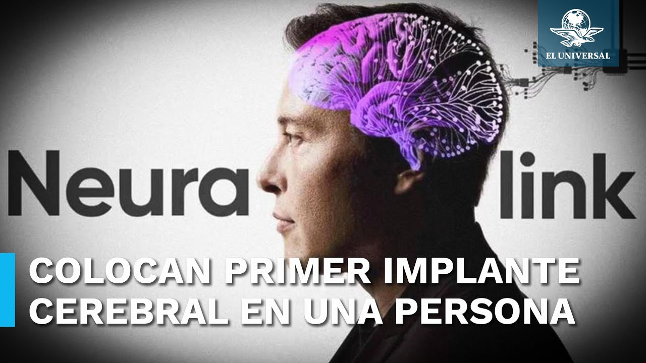 Elon Musk anuncia que Neuralink realizó el primer implante de chip ...