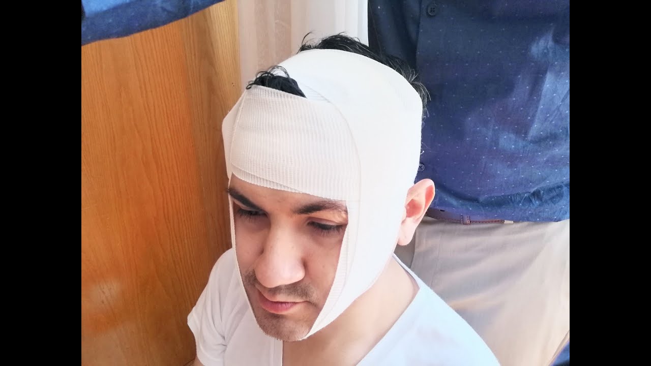 Cabeza - Vendaje oblicuo para soporte mandibular - YouTube