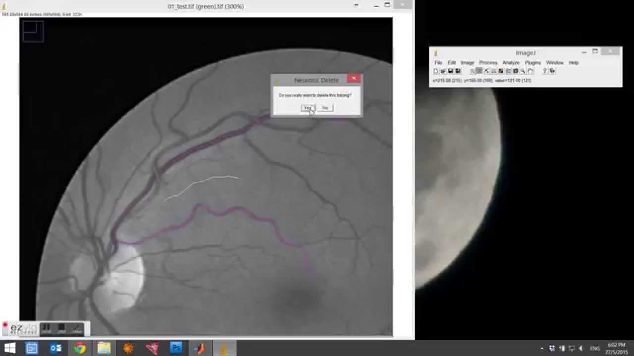 Vessel Centerline Annotation Demo - YouTube