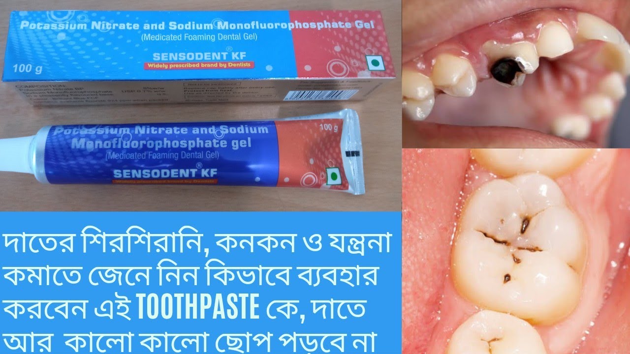 Sensodent KF (One of the best toothpaste widely prescribed by dentists ...