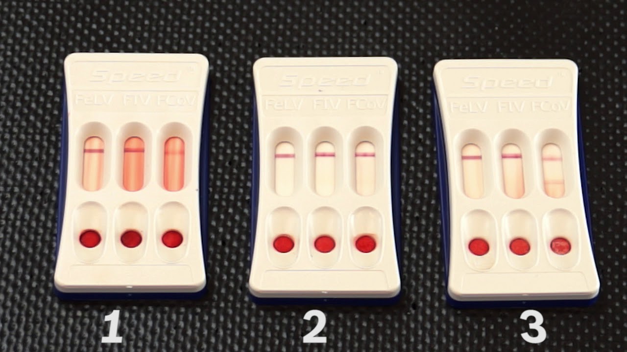 How to perform a Speed Trio test - YouTube