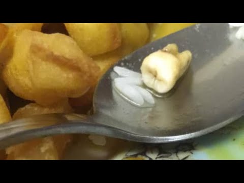 They Found My My Teeth In The Chinese Buffet - YouTube