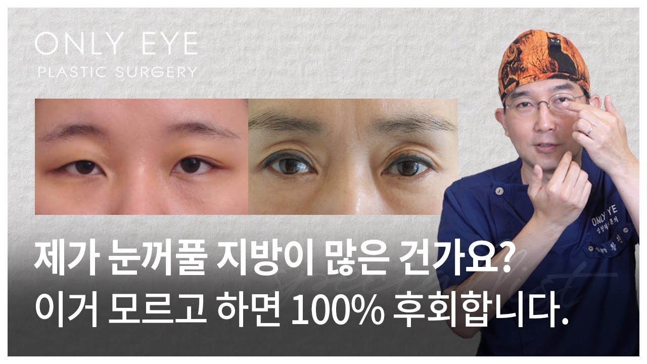 눈두덩이 눈 지방 제거 고민이시라면 눈성형만 하는 온리아이성형외과 Youtube