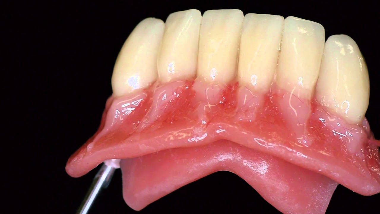 PALA cre-active individualize the denture Heraeus english - YouTube