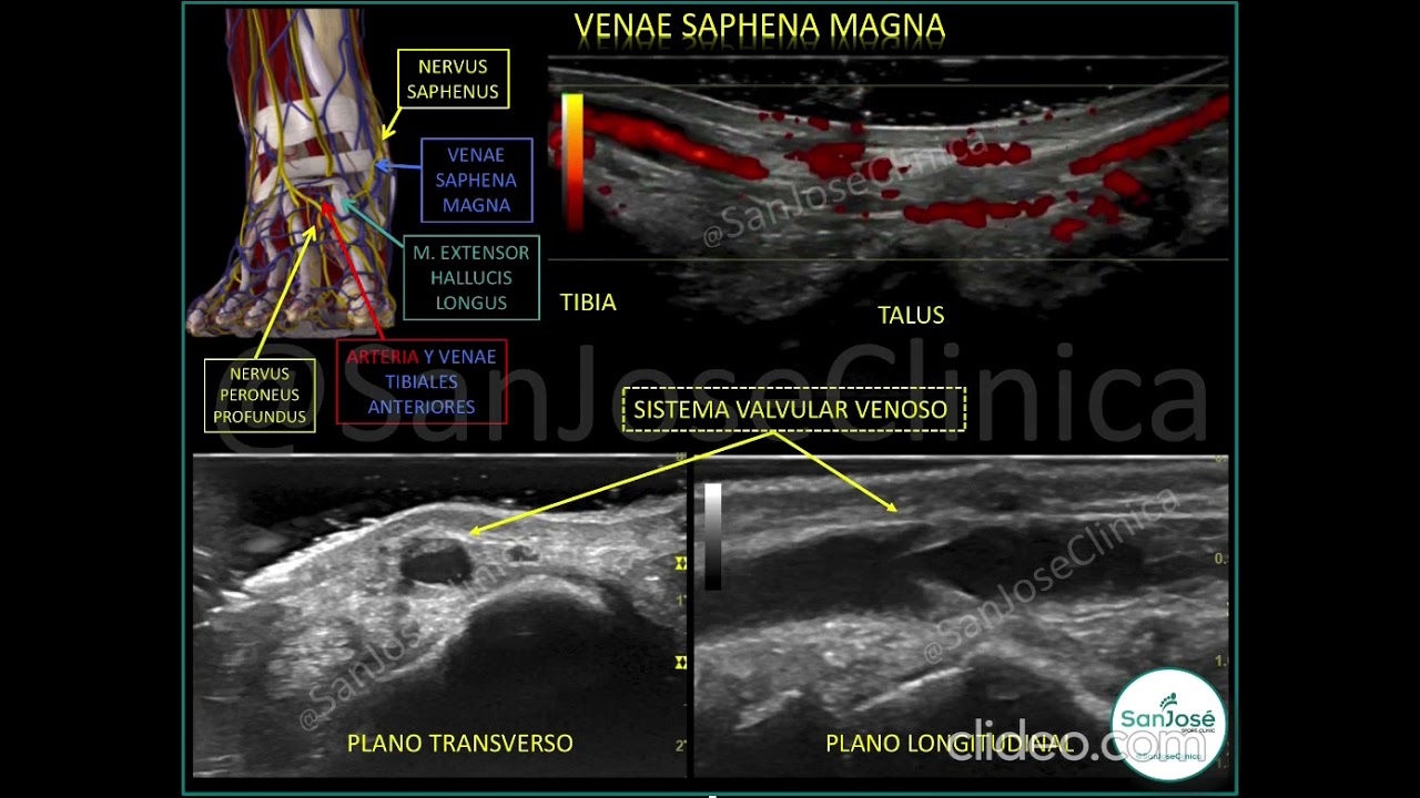 Vena Saphena Und Nerv