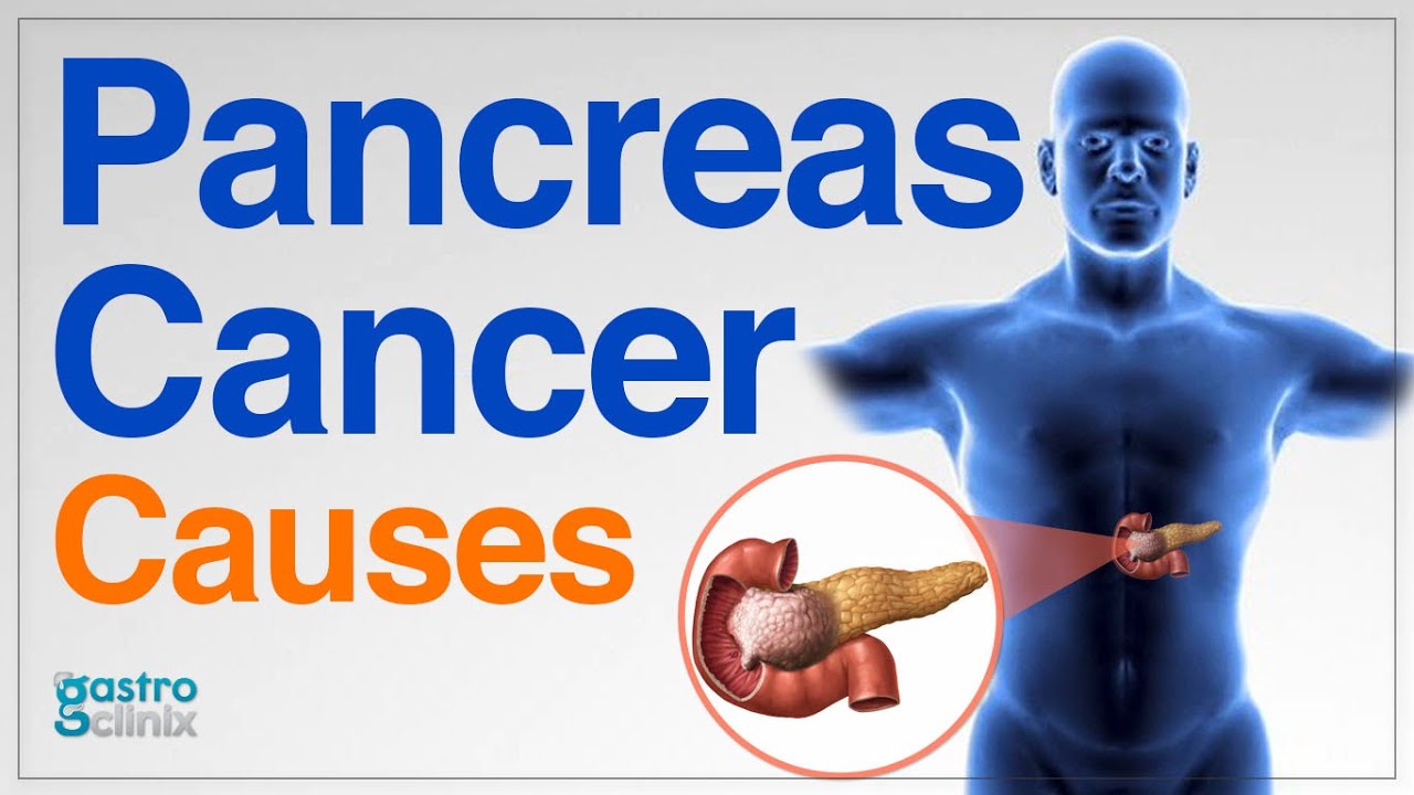 Why does Pancreas Cancer occur ? - YouTube