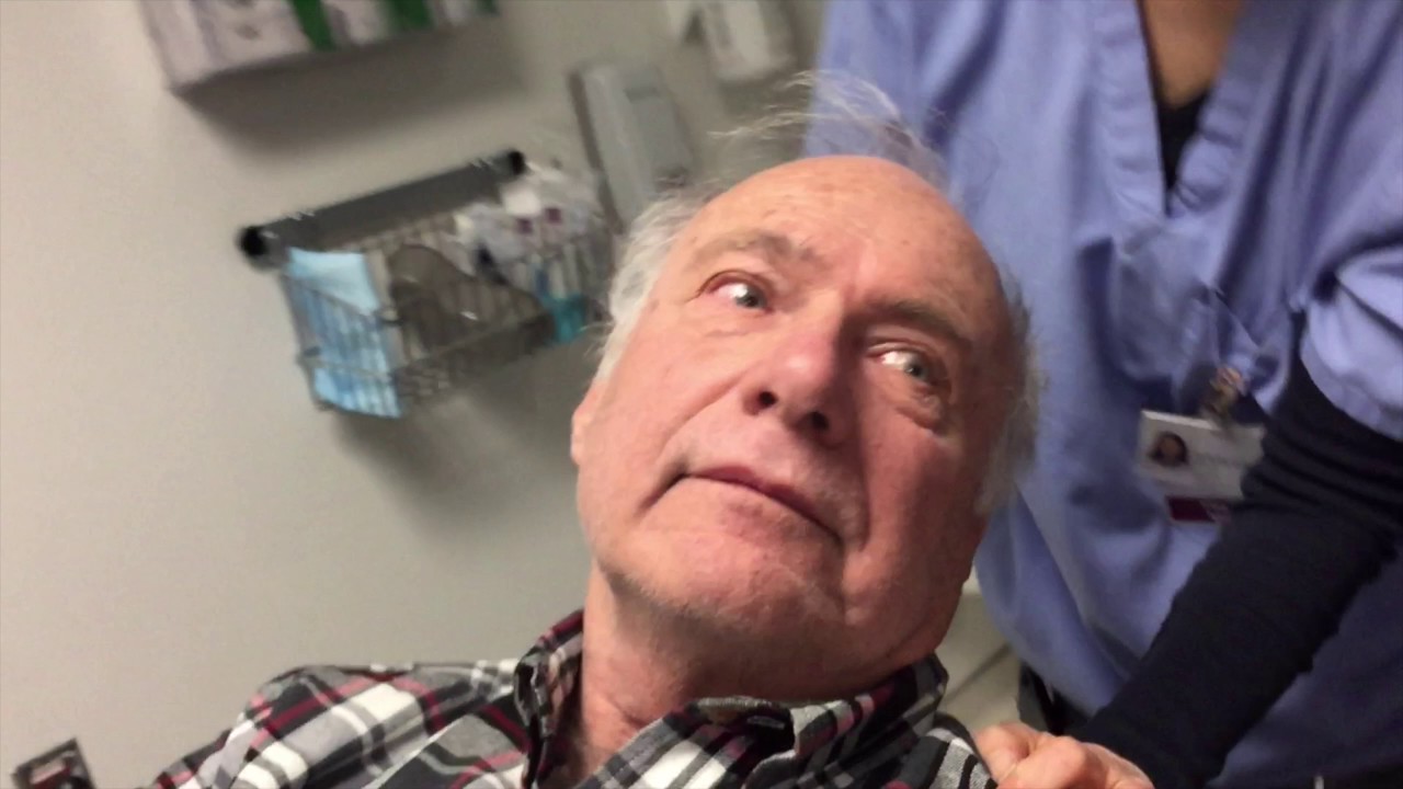 Positive Dix Hallpike Test - YouTube