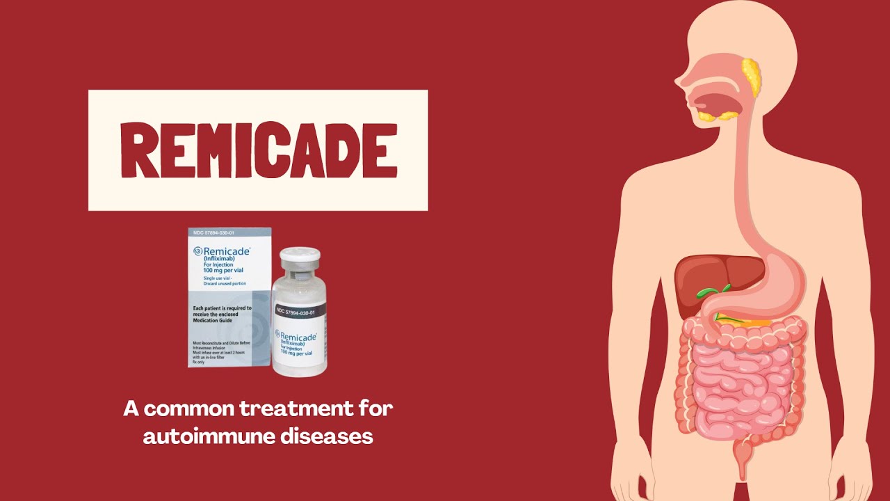 TMM 3104 Group 4 - Remicade - YouTube