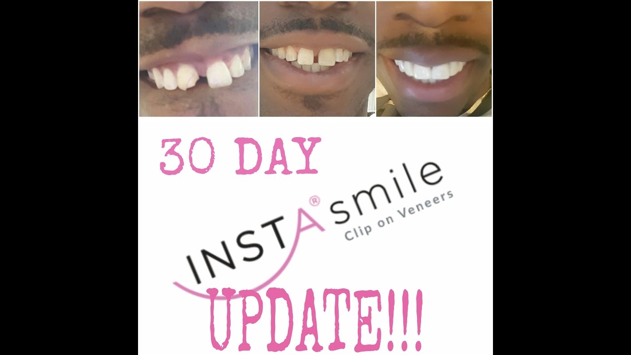 INSTASMILE 30 DAY UPDATE: You can eat w/ them - YouTube
