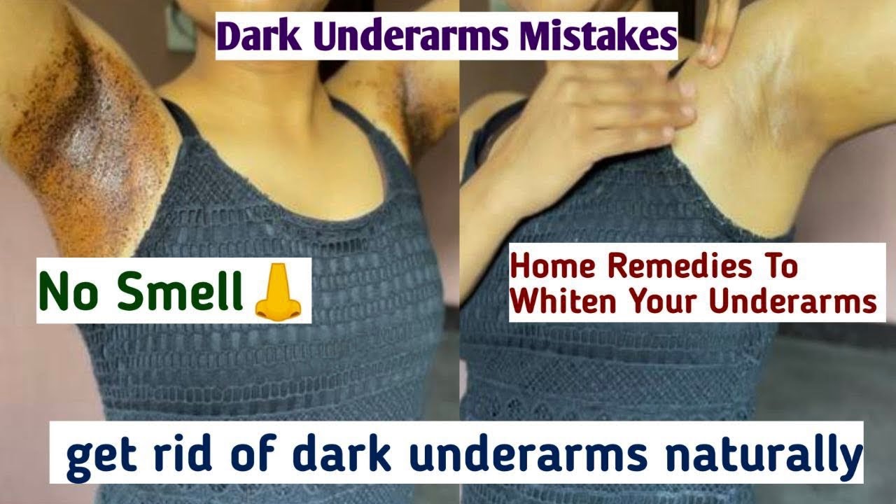 Dark Underarms Mistakes |Home Remedies To Whiten Your Underarms| get ...