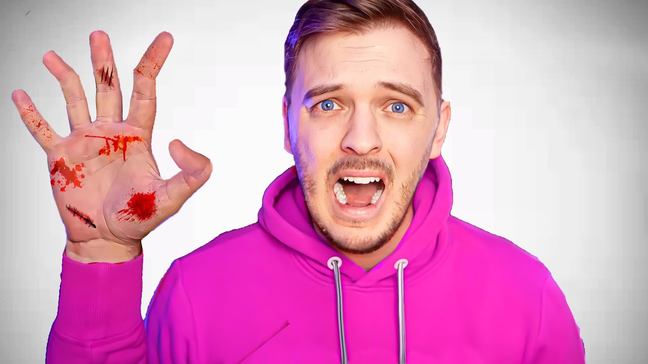 JE ME SUIS CASSÉ LA MAIN.. ( Rip ) - YouTube