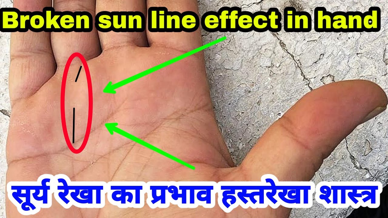 Broken sun line effect in hand ! सूर्य रेखा का प्रभाव हस्तरेखा शास्त्र ...